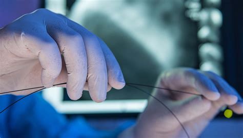 Interventional Cardiology Dr Moedi