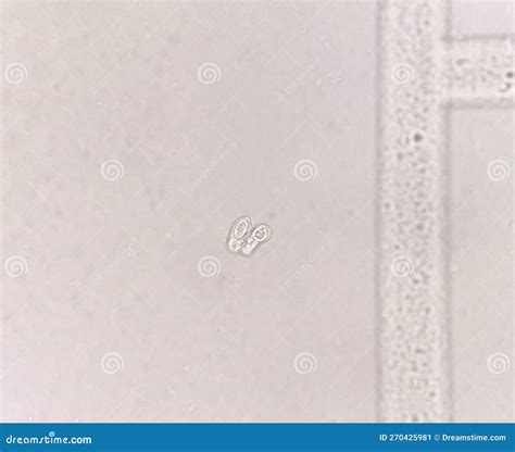 Renal Tubular Epithelial Cell In Urine Stock Image Image Of Illness