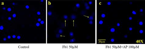 Nuclear Morphology Observation By Dapi Staining In Hepg2 Control Cells Download Scientific