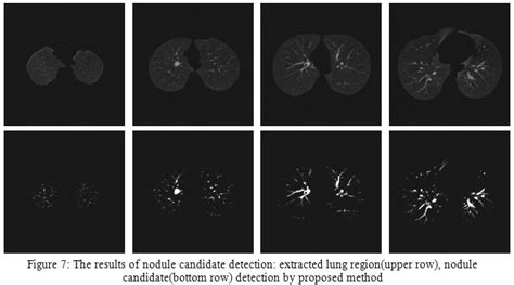 automated pulmonary lung nodule detection using an optimal manifold