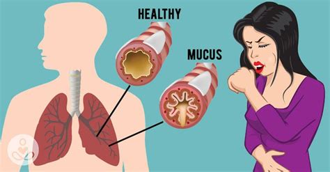 Phlegm In Chest