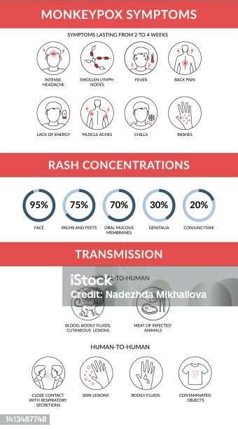 원숭이 두 바이러스 증상 전염 및 발진 농도 원숭이 인포 그래픽에서 감염의 발생 선형 벡터 일러스트 레이 션 건강 진단에 대한 스톡 벡터 아트 및 기타 이미지 Istock