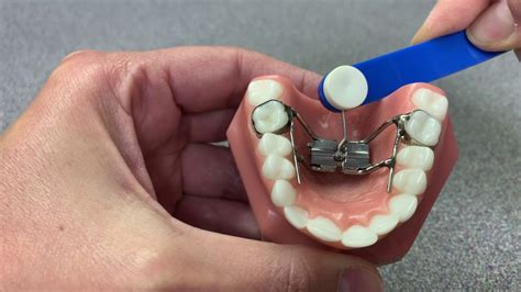 How To Turn Your Expander YouTube