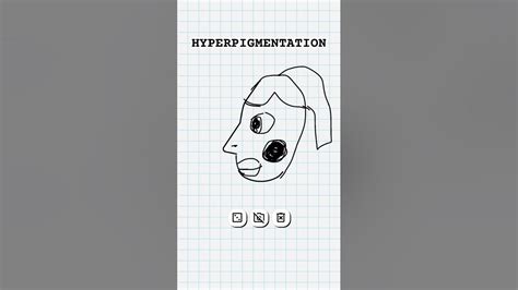 Hyperpigmentation Drawing Tutorial Sketch Artist Youtube