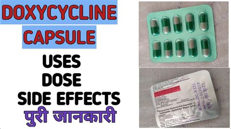 DOXYCYCLINE CAPSULE MG USES DOSE SIDE EFFECTS DOXT SL MINICYCLINE REVIEW YouTube