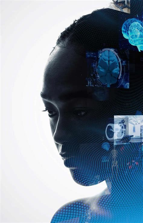 Mdbrain Ai Based Solution For Quantitative Neuroimaging