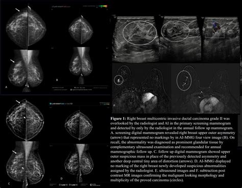 Sahar Mansour On Linkedin Artificialintelligencealgorithms