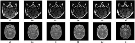 Fusion Results Of Dataset 1 A 7 B 33 C 34 D 35 E Download Scientific