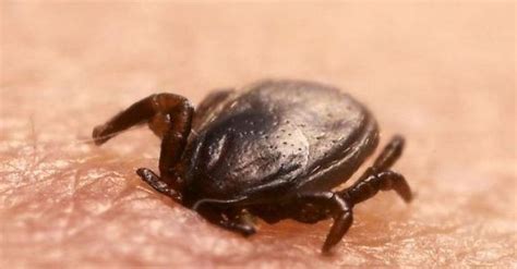 Орхон аймагт хачигт хазуулсан 33 настай залуу нас баржээ · Dorgio Mn