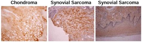Osteocalcin Monoclonal Antibody Ocg4 Invitrogen 50120 100ug