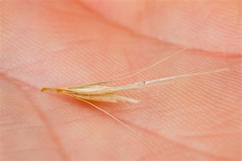 여우 꼬리 잔디의 작은 화살촉의 매크로 사진입니다 개가 여름 동안 머리를 흔들거나 발을 핥는 내 상담실에 들어갈 때 가능한 진단 목록의 상단은 항상 두려운 잔디 씨앗입니다