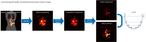 Deep Learning Based Attenuation Correction For Lu 177 Spect Imaging Journal Of Nuclear Medicine