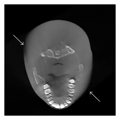 Different Initial Images And Iterative Reconstruction Results Of Real