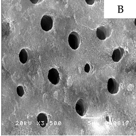The Dentin Micro Morphology With 375 Percent Phosphoric Acid Applied Download Scientific