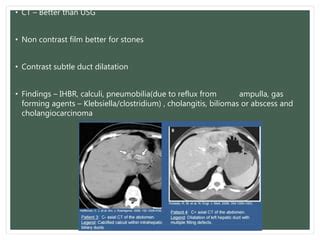 Recurrent Pyogenic Cholangitis PPTX
