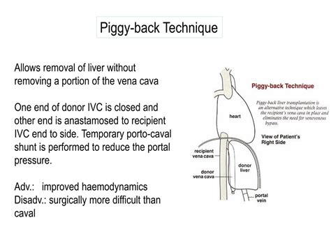 Ppt Liver Transplantation Surgery Basics By Dr Ch Madhusudhan Ms
