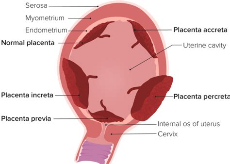 Placenta Descubre Las Partes Clave De Su Anatomía Y Función
