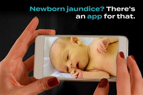Jaundice Newborn Bilirubin Levels Neonatal Jaundice Is Common In