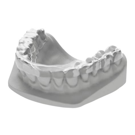 Digital Deprogramming Splint Odl Orthodontic Labs