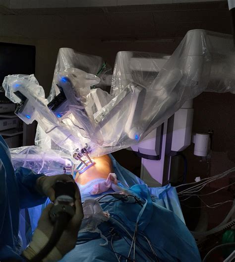 Rats Left Upper Lobectomy R Indianmedschool