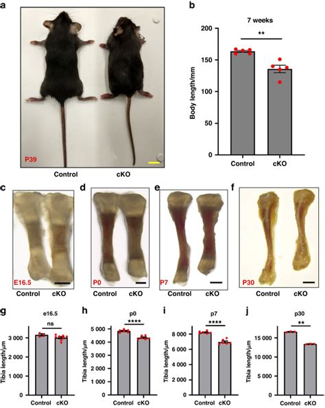 α Parvin 控制软骨细胞柱形成并调节长骨发育bone Research X Mol
