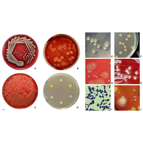 Jual Isolat Staphylococcus Aureus Subsp Aureus Rosenbach Atcc 25923 Shopee Indonesia