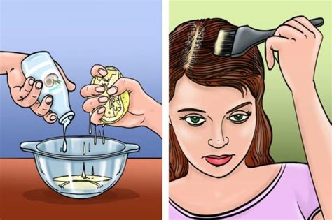 Easy And Practical Ways To Remove Dandruff At Home