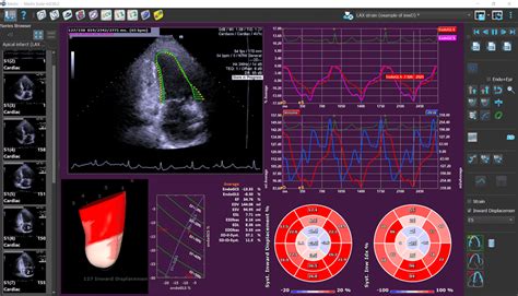 Ge Clarius Butterfly Which Ultrasound Brand Offers The Best Value