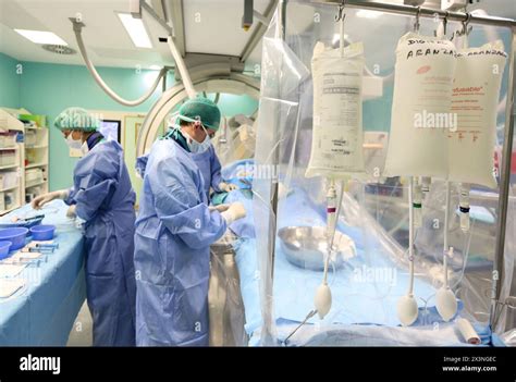 Cerebral Aneurysm Embolization Interventional Neuroradiology Radiology Department Donostia