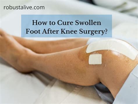 Build A Info About How To Get Rid Of A Swollen Knee Gununique