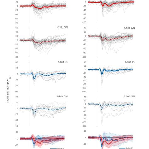 Meeg Combined Source Estimates In The Left And Right Transverse