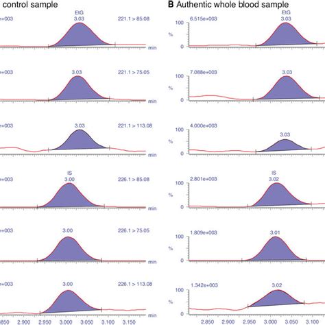 Chromatograms Obtained From The Analysis Of Ethyl Glucuronide Etg In Download Scientific