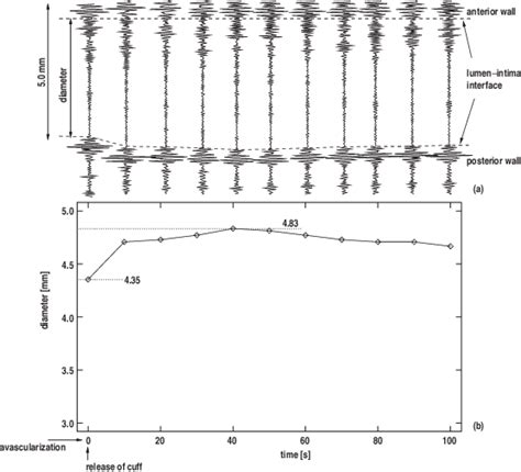 A RF Signal Obtained At Each Measurement After Release Of Cuff Download Scientific Diagram