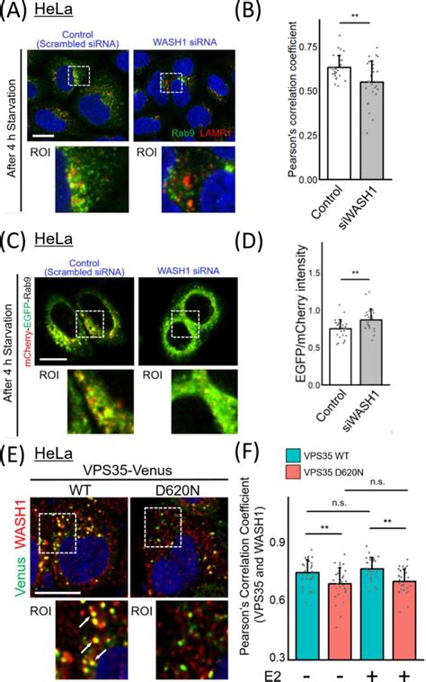 The Impact Of Vps35 D620n Mutation On Alternative Autophagy And Its