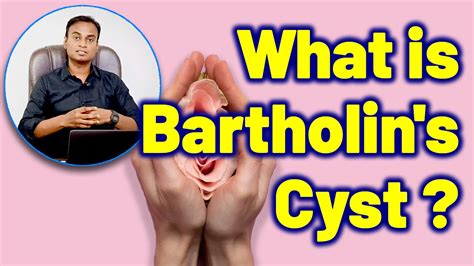 What Is Bartholin Cyst Bartholin Cyst Abscesses Treatment Cure