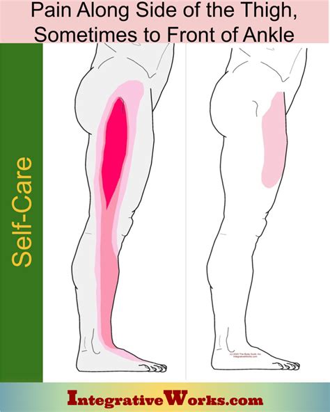 Tensor Fasciae Latae Trigger Point Tensor Fasciae Latae Trigger Point