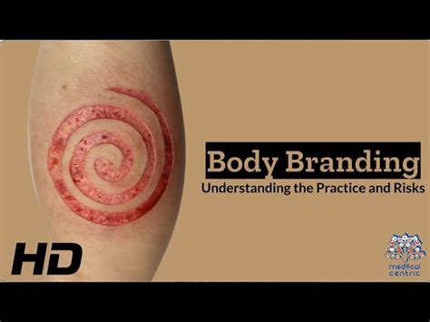 Healed Branding Tattoo
