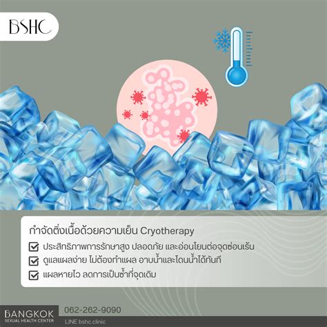 Cryotherapy For Hpv Wart Bangkok Sexual Health Center