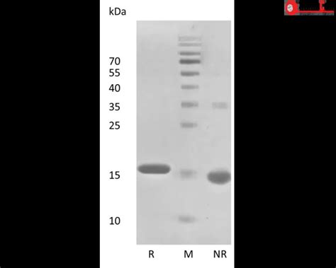 Recombinant Human Interferon Alpha2b Rhifn α2b