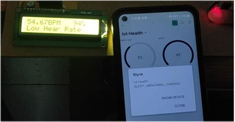 Iot Based Advanced Cardiac Arrest Detection System