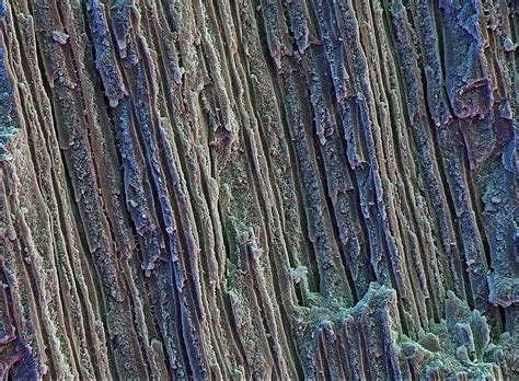 Tooth Dentine Sem Stock Image P486 0073 Science Photo Library