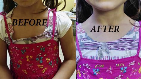 How To Make A Neckline Smaller YouTube