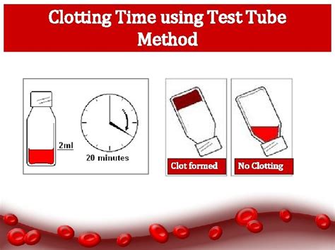 Clotting Time Ct Purpose Procedure Results Risks And Lti