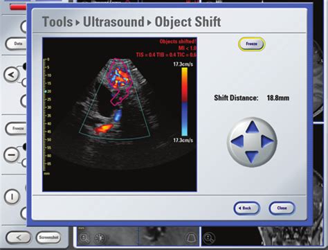 Case 14 Neuronavigation System Screenshot Demonstrating The Use Of The Download Scientific