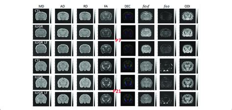 Diffusivity Mean Md Axial Ad Radial Rd Fractional Anisotropy Download Scientific