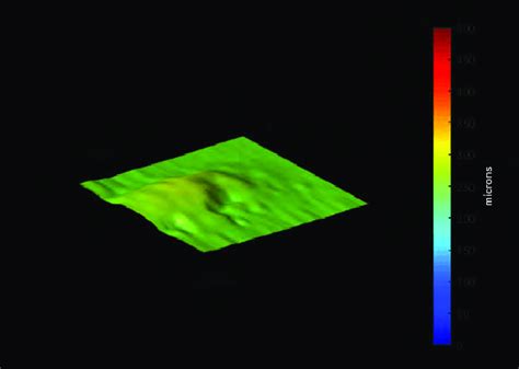 Reconstructed 3d Retinal Thickness Surface Of A Randomly Selected Download Scientific Diagram