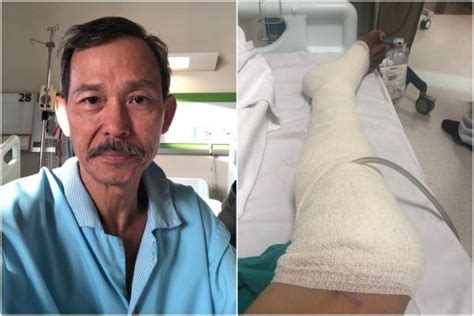 Local Actor Duan Weiming Who Is Diabetic Glad That He Does Not Have To Undergo Amputation