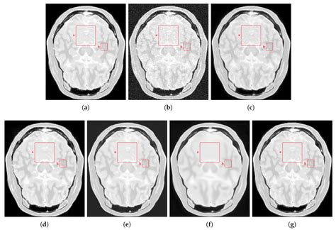 Sensors Free Full Text Non Local Svd Denoising Of Mri Based On