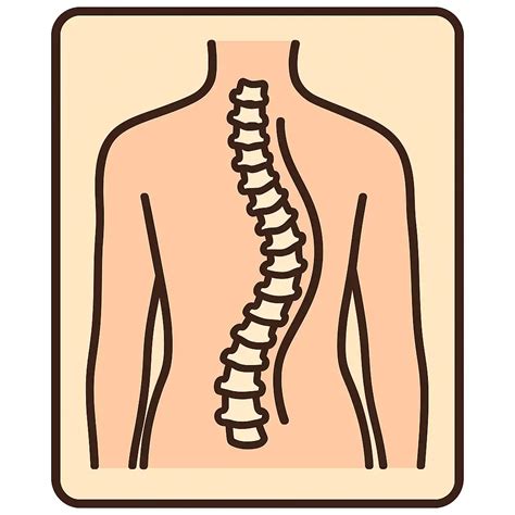 Scoliosis Icd 10 What The Code Means And How It Relates To Scoliosis