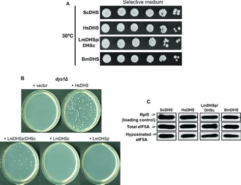 Functional Replacement Complementation Of Yeast Deoxyhypusine Download Scientific Diagram
